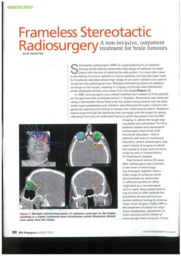 Medical Grapevine Asia: Frameless Stereotactic Radiosurgery