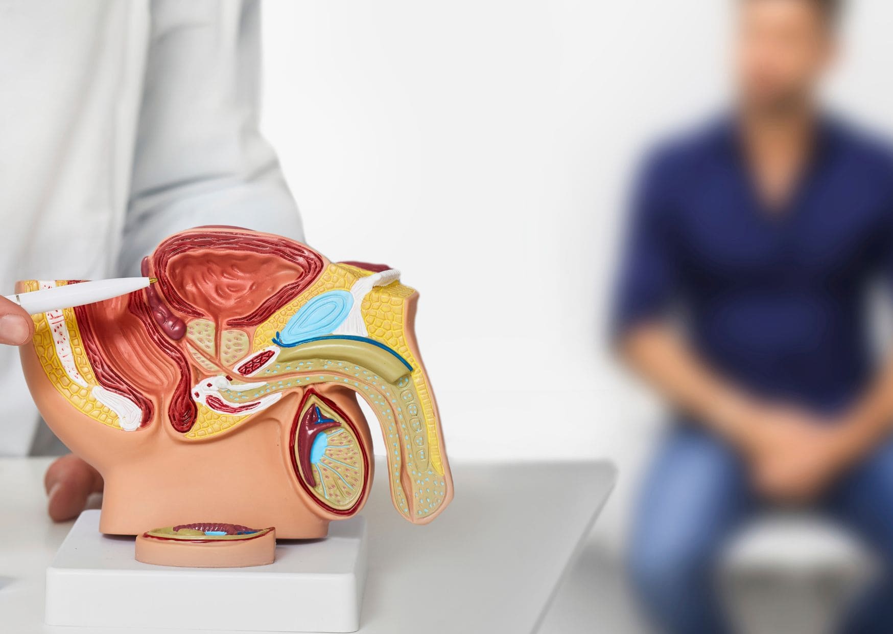 Prostate Cancer Stages and What They Mean | AARO